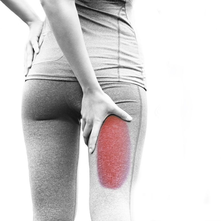 Ciática - Centro Quiropráctico